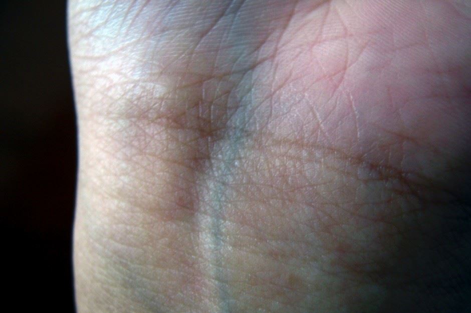 Kenapa Urat Kita Nampak Warna Biru Hijau, Tapi Darah Warna Merah? | THR ...