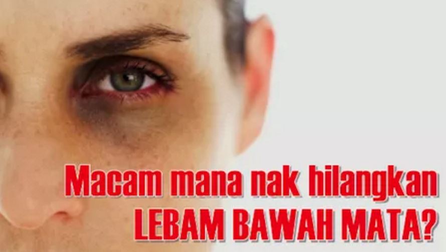 Ada Masalah Bawah Mata Hitam? Tengok Petua Ini! | THR GEGAR