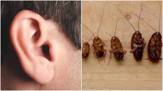 Man Finds Family Of Cockroaches Living In His Ear! | HITZ