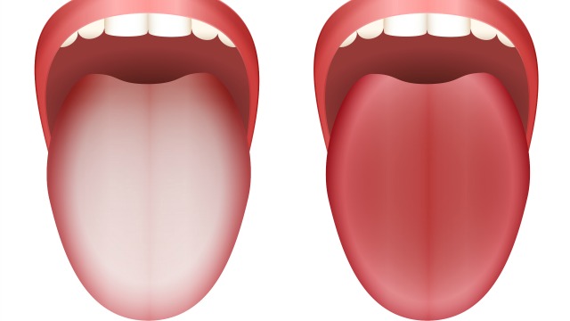 Your Tongue Has A Few Things To Tell You About Your Health! 13 Things ...