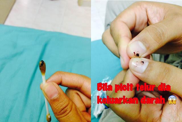 Jangan Biarkan Anak Main Kucing Liar, Ibu Terkejut Sengkenit Bersarang ...