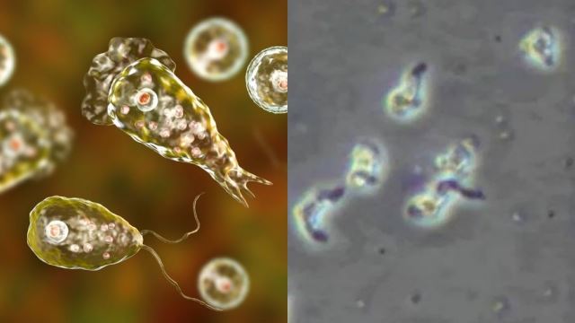 ‘Amoeba Pemakan Otak’ Dikesan Di Korea Selatan, Boleh Masuk Tubuh Manusia | SINAR
