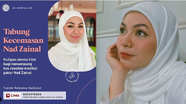 Kutipan Derma Kilat Bagi Membantu Kos Rawatan Nad Zainal | SYOK